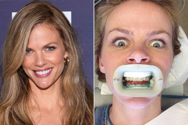 Unflattering Celebrity Pictures That Prove They Also Fall Victims To ...